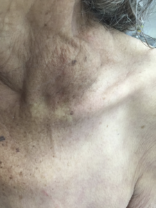 Classification de Garden - NPEM